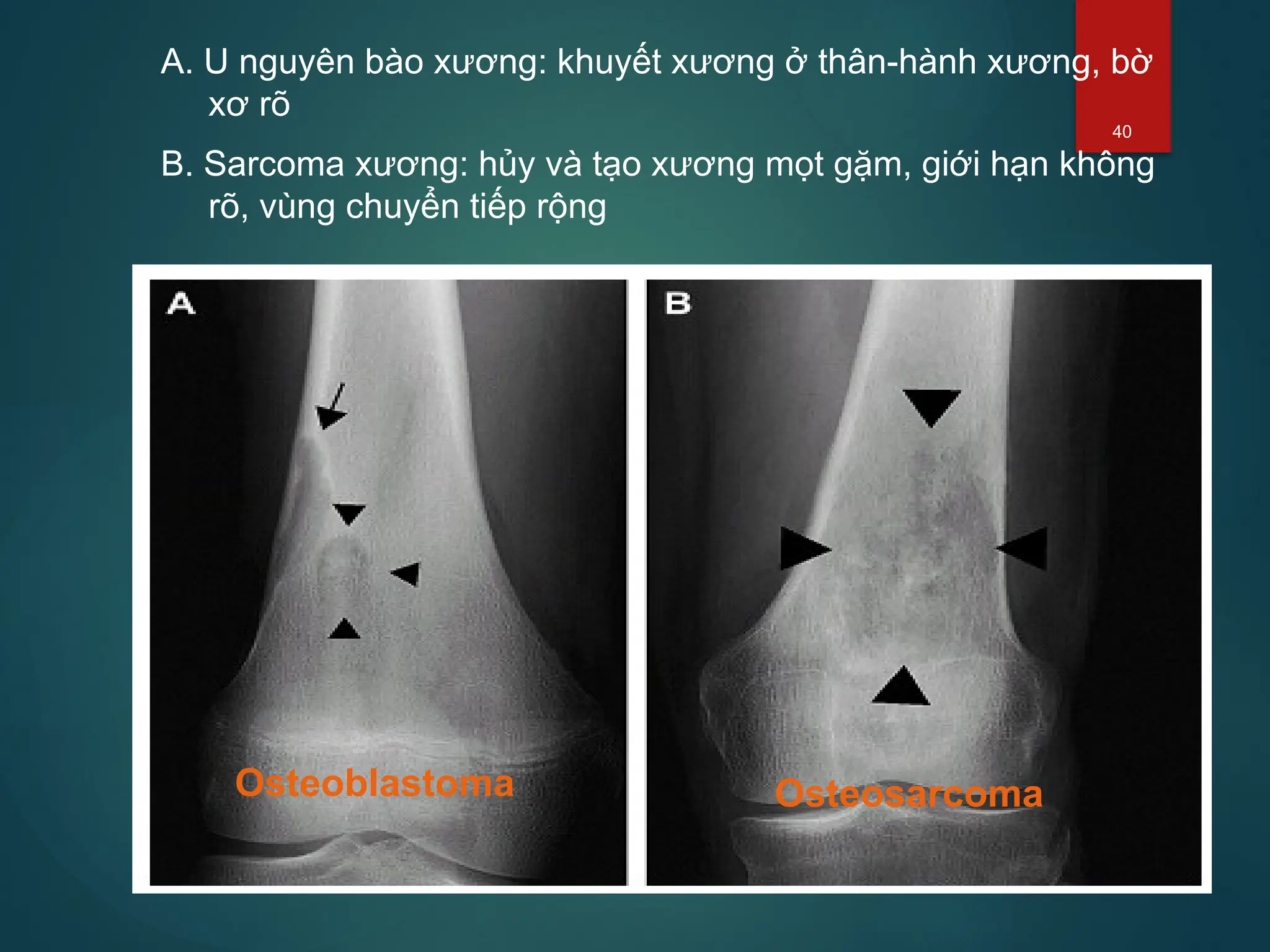Dai cuong hinh anh hoc co xuong khop-2.ppt | Free Download