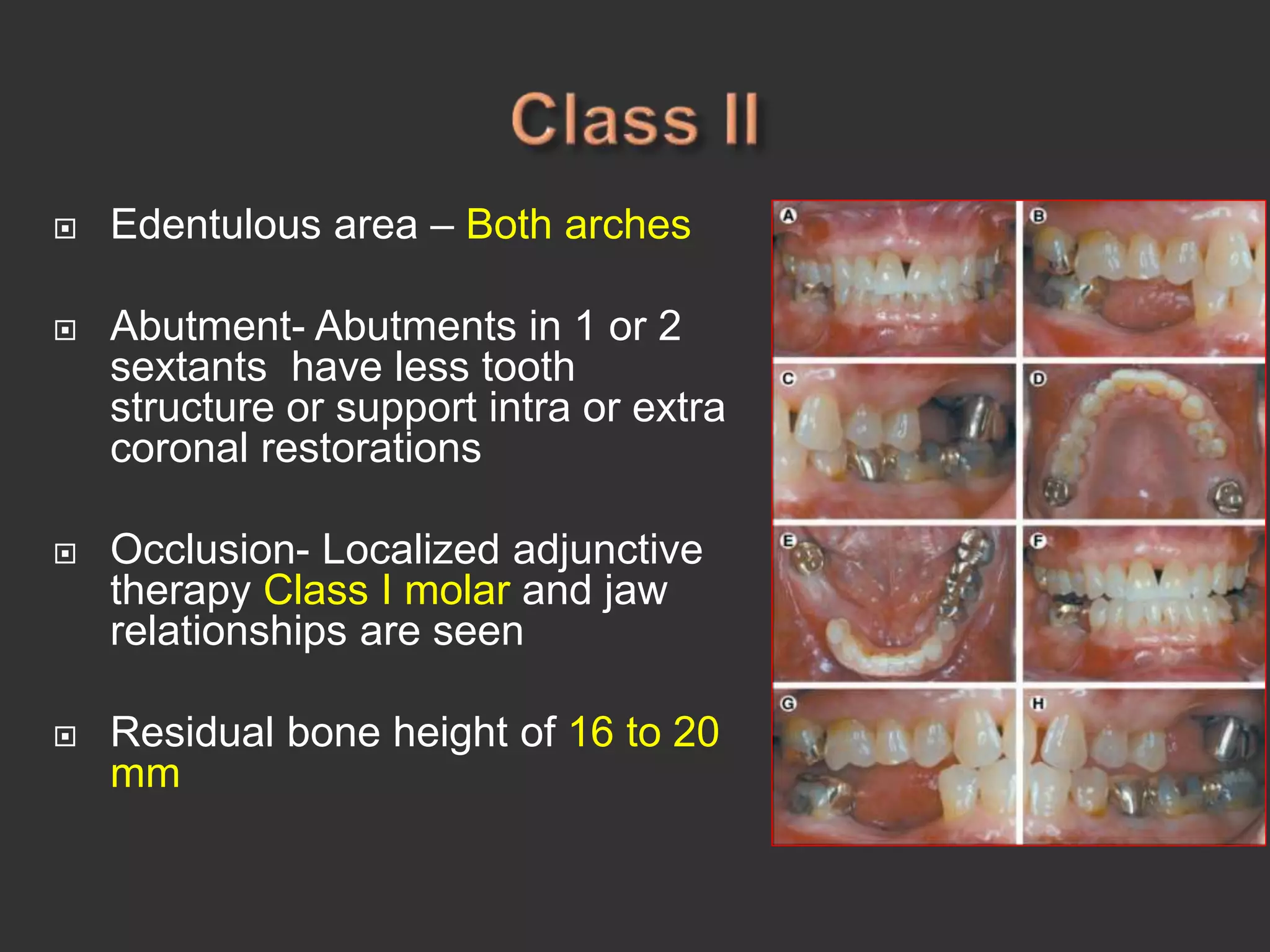 Diagnosis and treatment planning in removable partial denture | PPTX
