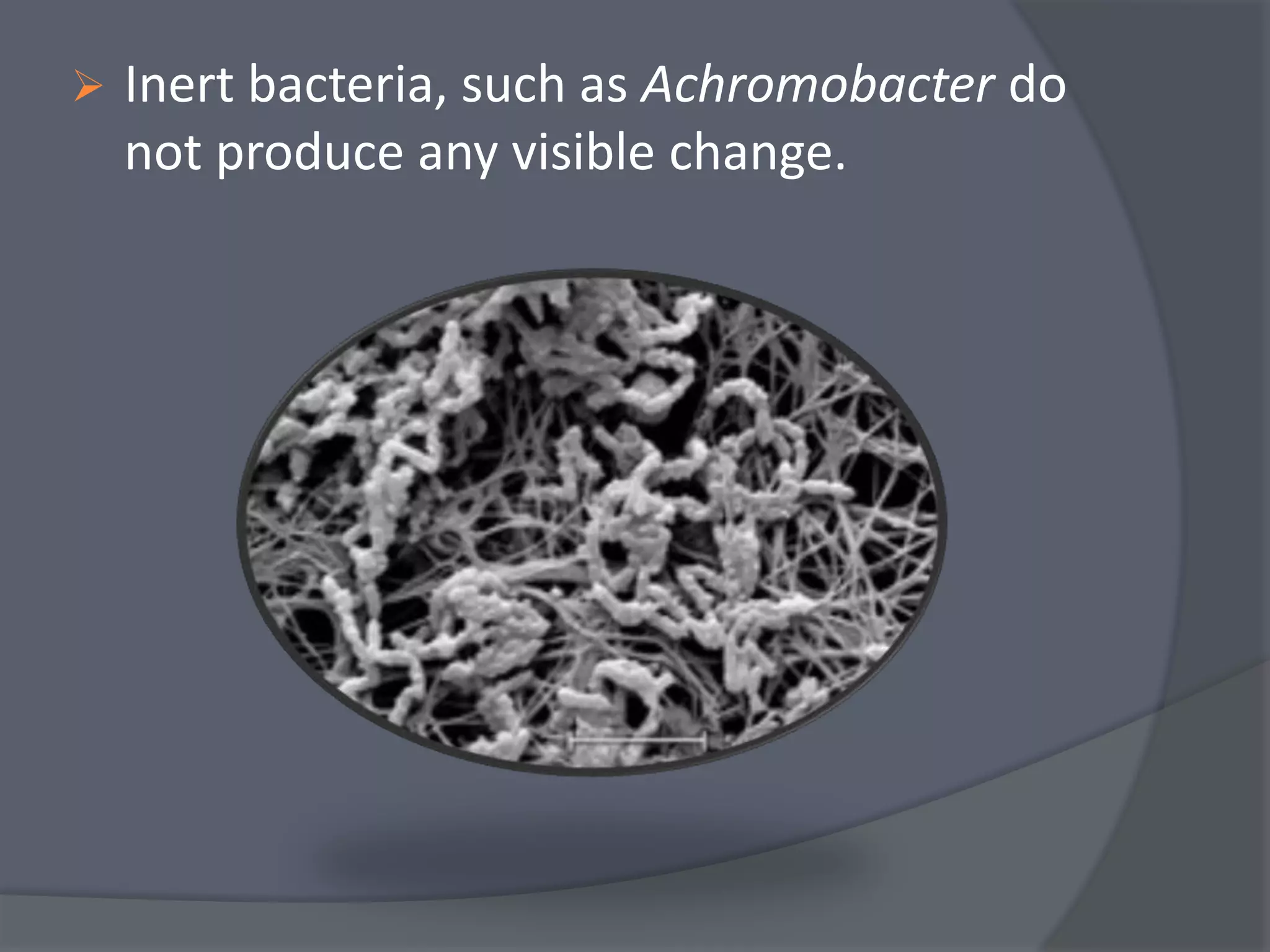 Study of Microorganism in Milk(Dairy microbiology) | PPTX