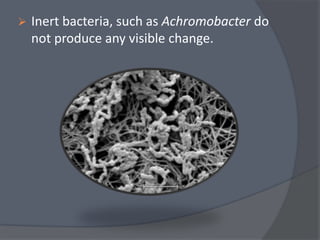Study of Microorganism in Milk(Dairy microbiology) | PPTX