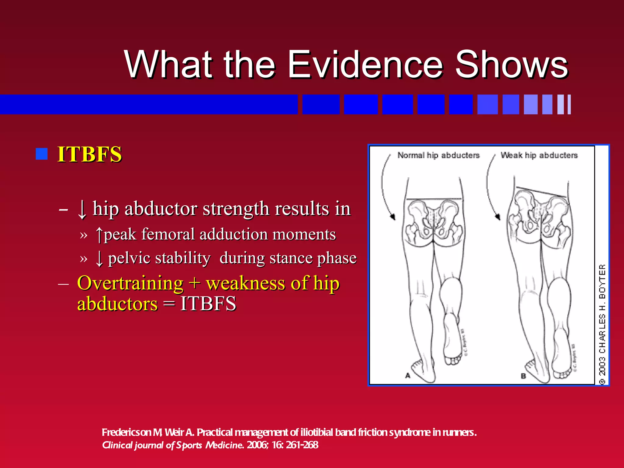 Current Concepts in Patellofemoral Pain Syndrome: Treatment and ...