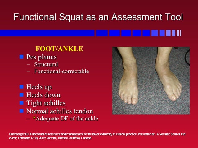 Current Concepts in Patellofemoral Pain Syndrome: Treatment and ...