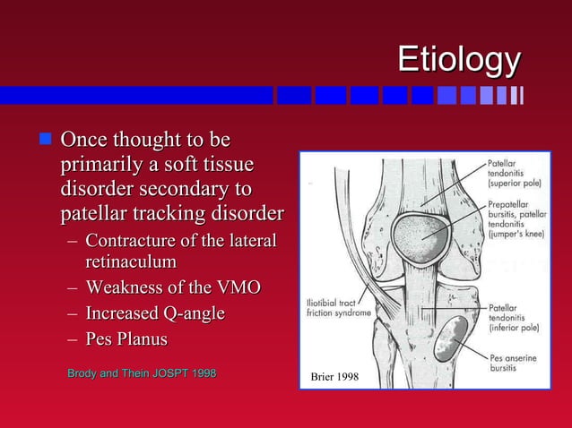 Current Concepts in Patellofemoral Pain Syndrome: Treatment and ...