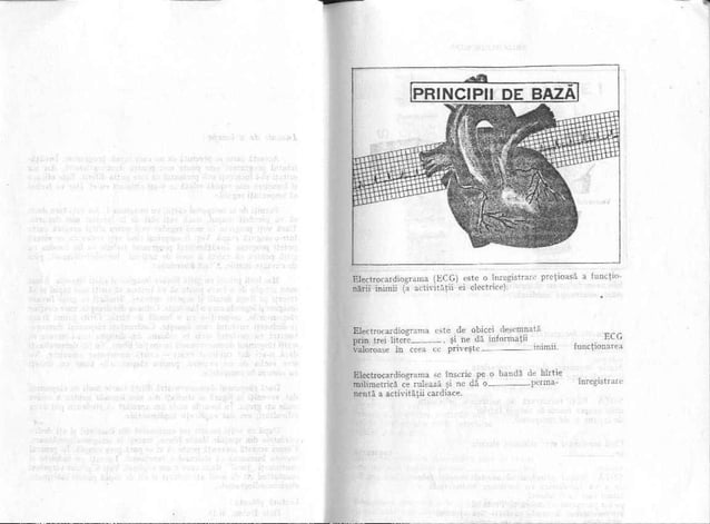 Dale Dubin Interpretarea rapida a EKG-ului.pdf