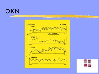 oculomotor reflexes | PPT