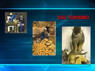 Daltonismo | PPT