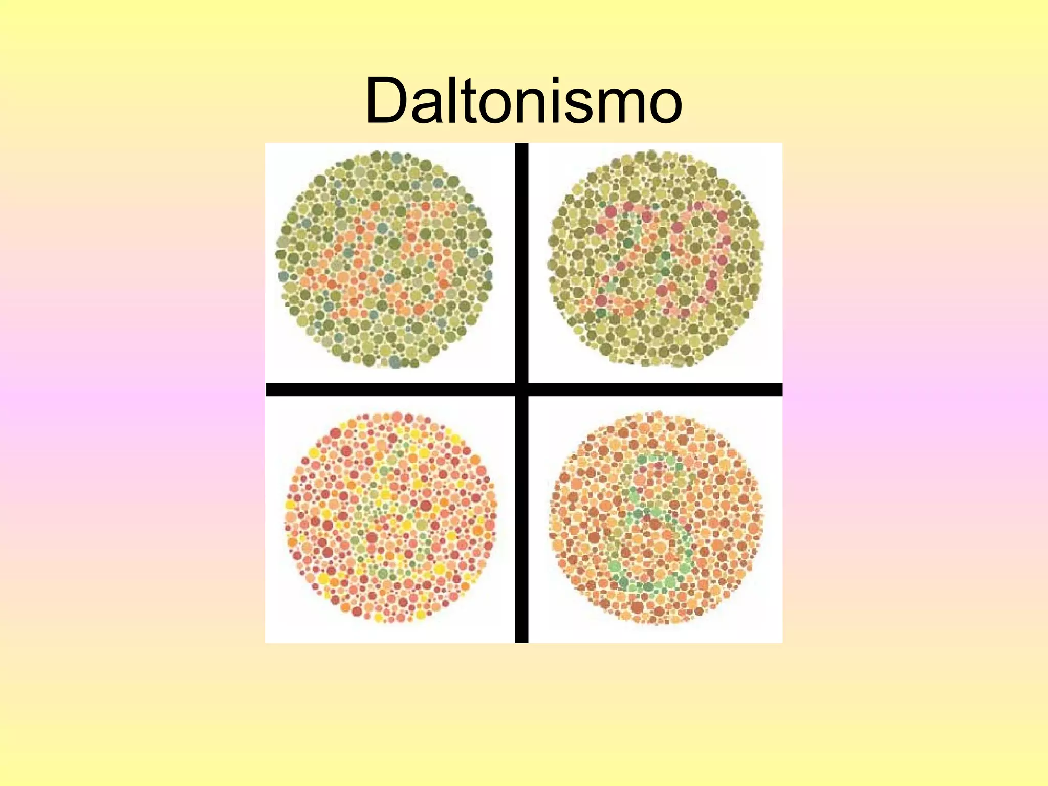 Daltonismo | PPT