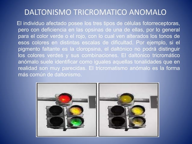 Daltonismo | PPT