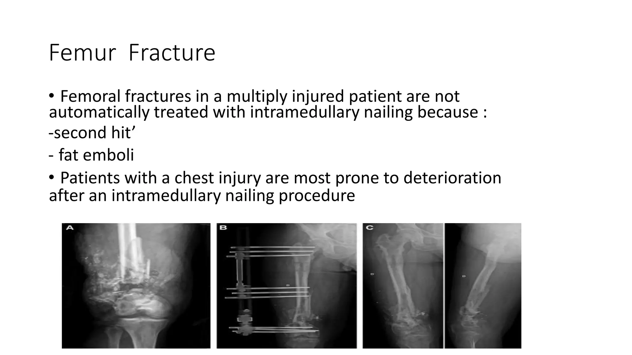 DAMAGE CONTROL ORTHOPAEDICS.pptx
