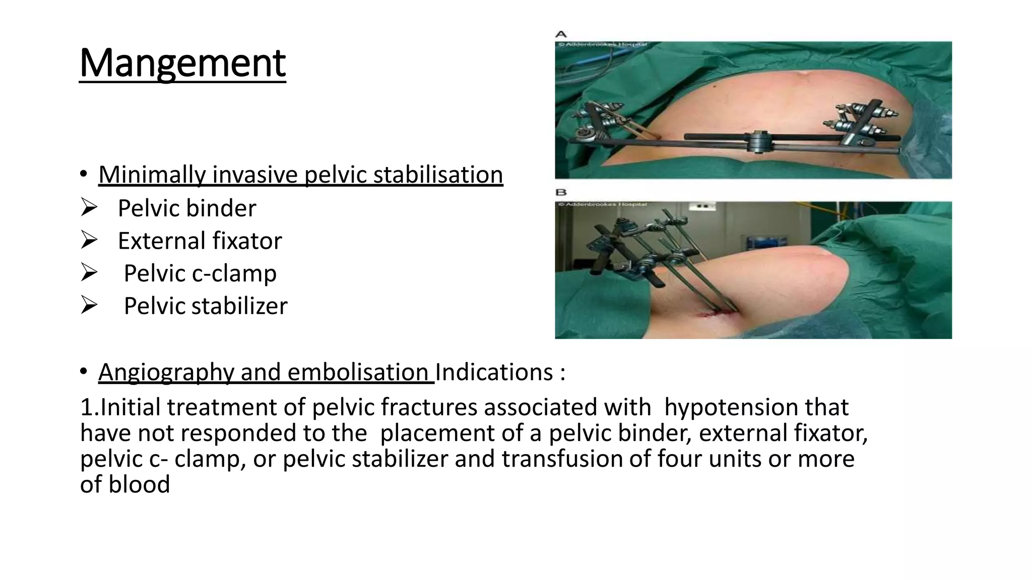 DAMAGE CONTROL ORTHOPAEDICS.pptx
