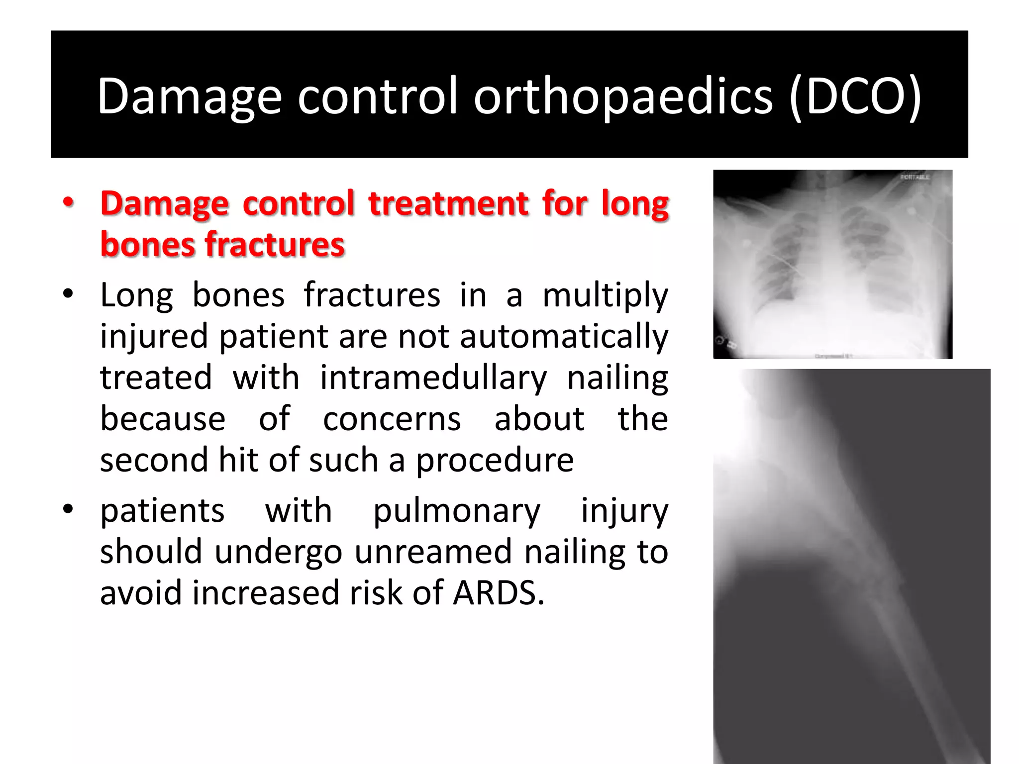 Damage control orthopaedic surgery | PPTX