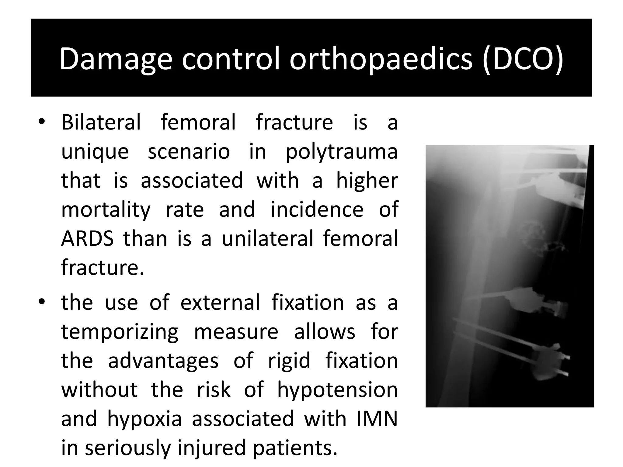 Damage control orthopaedic surgery | PPTX