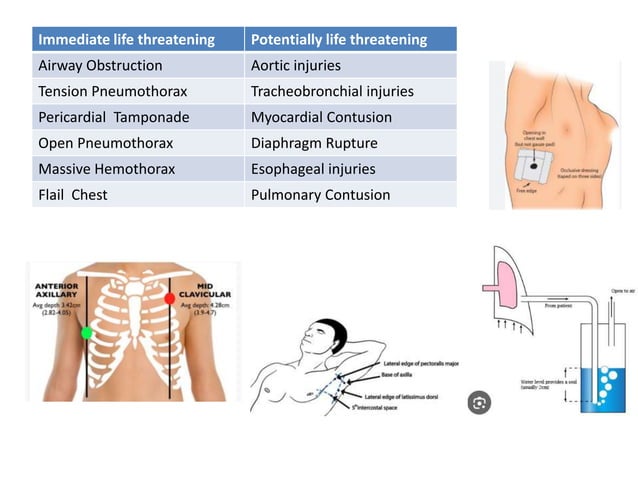 Appraoch to patient with polytrauma and Damage control orthopedics ...