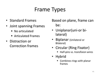 Damage Control Orthopedics and Principles of External Fixation.pptx