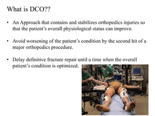 Damage control orthopedics klh | PPT