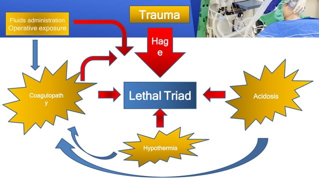 Damage control resuscitation roles of anaesthesiologist.pptx