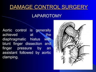 Damage control surgery | PPT