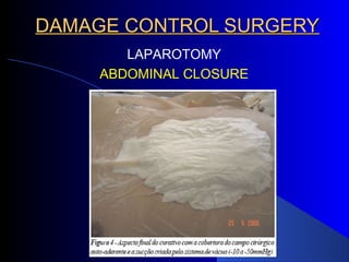 Damage control surgery | PPT