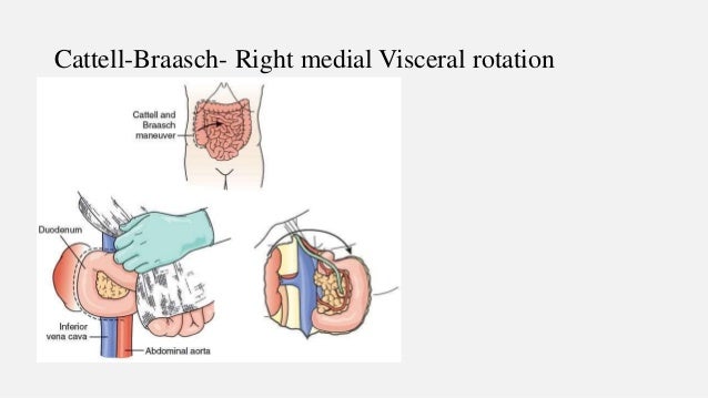 Damage Control Surgery by Dr.Damodhar.M.V