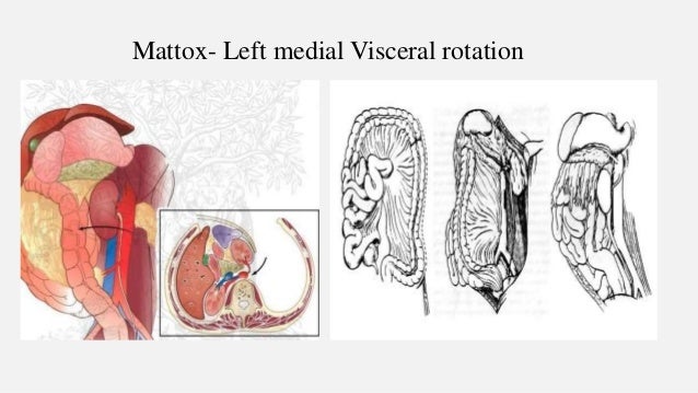 Damage Control Surgery by Dr.Damodhar.M.V