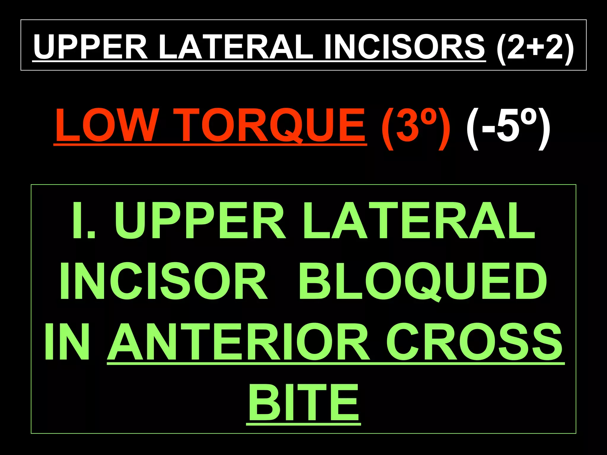 Damon selective torques | PPT