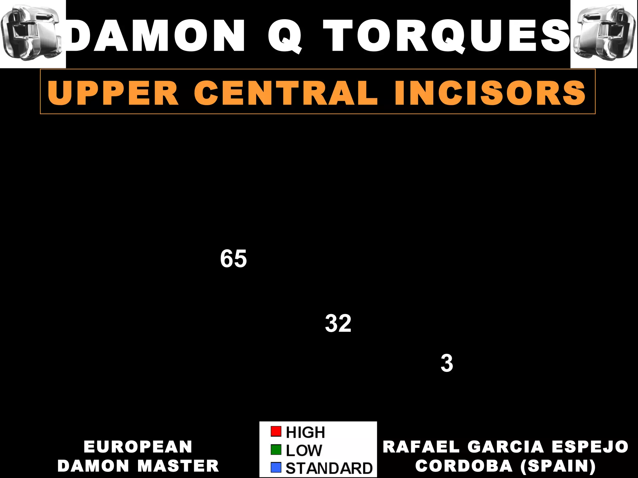 Damon selective torques | PPT