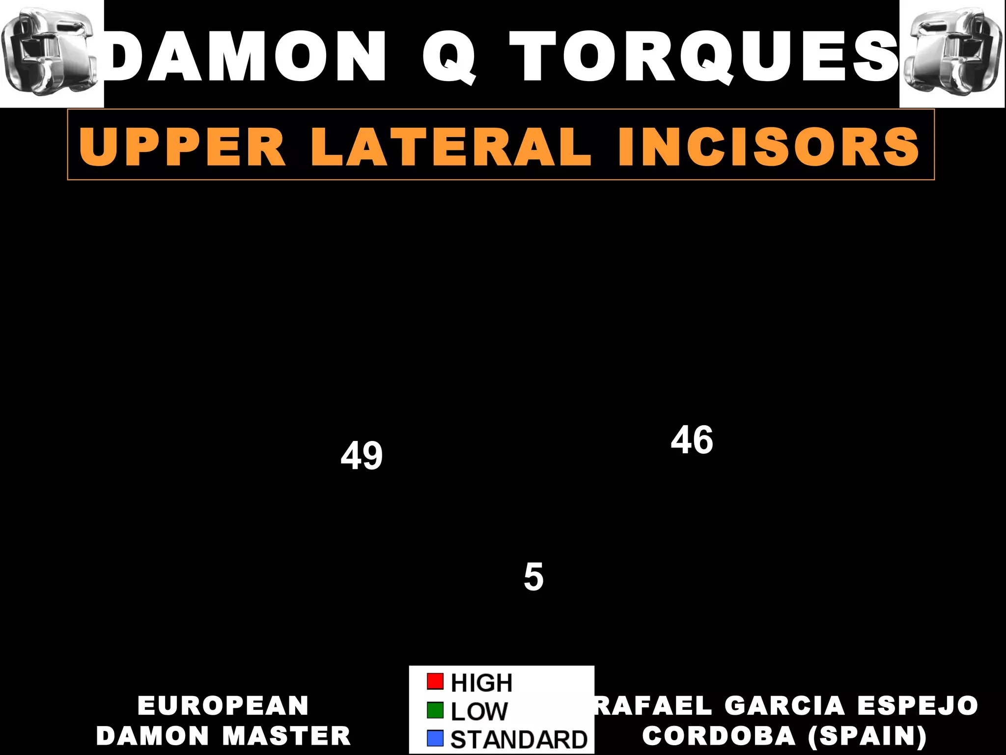 Damon selective torques | PPT