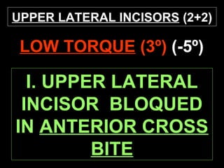 Damon selective torques | PPT