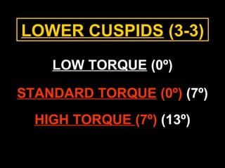 Damon selective torques | PPT