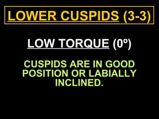 Damon selective torques | PPT