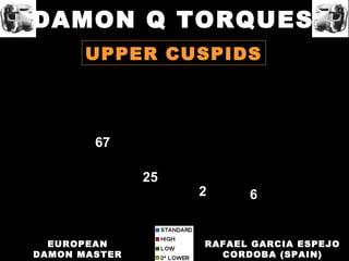 Damon selective torques | PPT