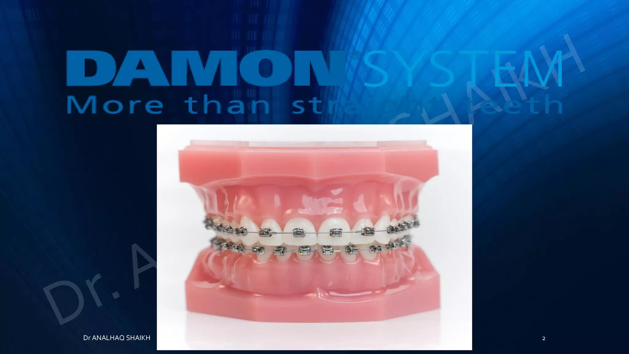 Damon system by Dr Analhaq Shaikh | PDF