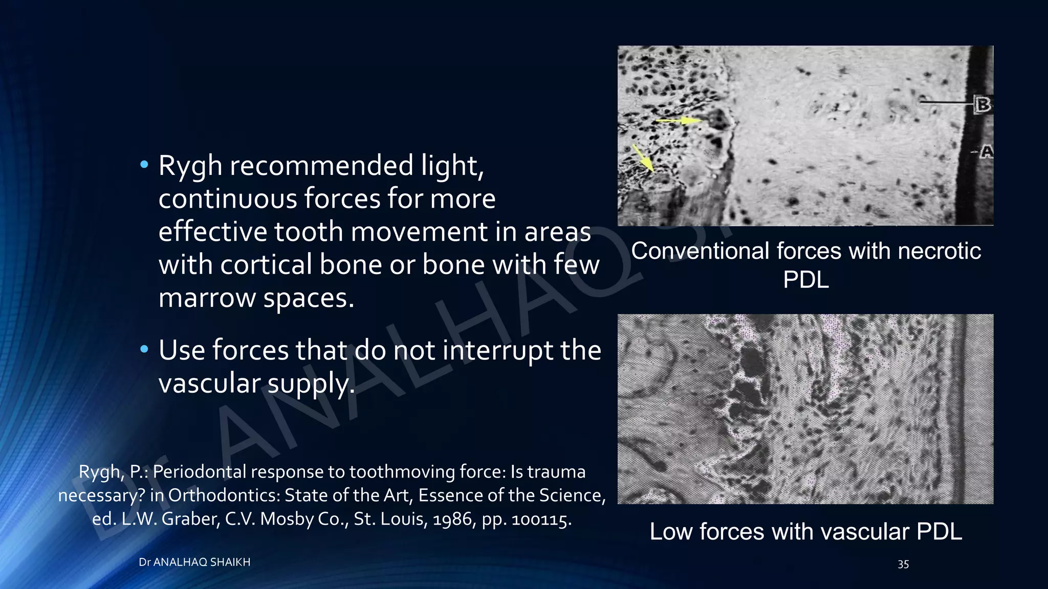 Damon system by Dr Analhaq Shaikh | PDF