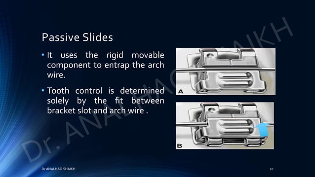 Damon system by Dr Analhaq Shaikh | PDF