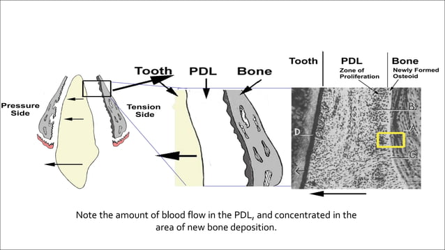 Damon system by Dr Analhaq Shaikh | PDF