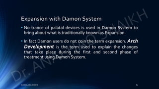 Damon system by Dr Analhaq Shaikh | PDF
