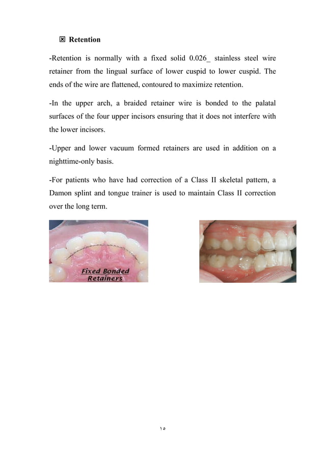 Damon system in orthodontics.pdf