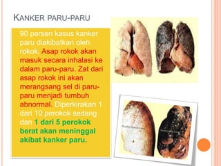 Dampak merokok bagi remaja dinkes mura | PPTX