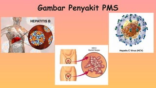 JENIS JENIS DAMPAK PENYAKIT MENULAR PMS.pptx