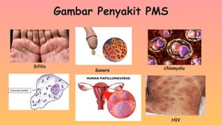 JENIS JENIS DAMPAK PENYAKIT MENULAR PMS.pptx