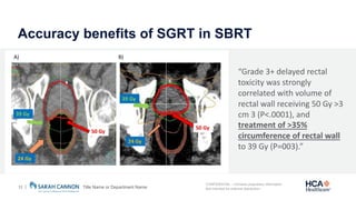 Benefits of System Standardization: Hypofractionated Prostate ...