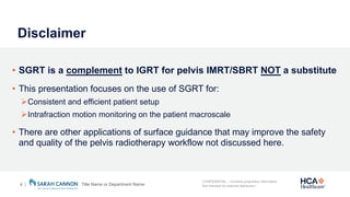 Benefits of System Standardization: Hypofractionated Prostate ...