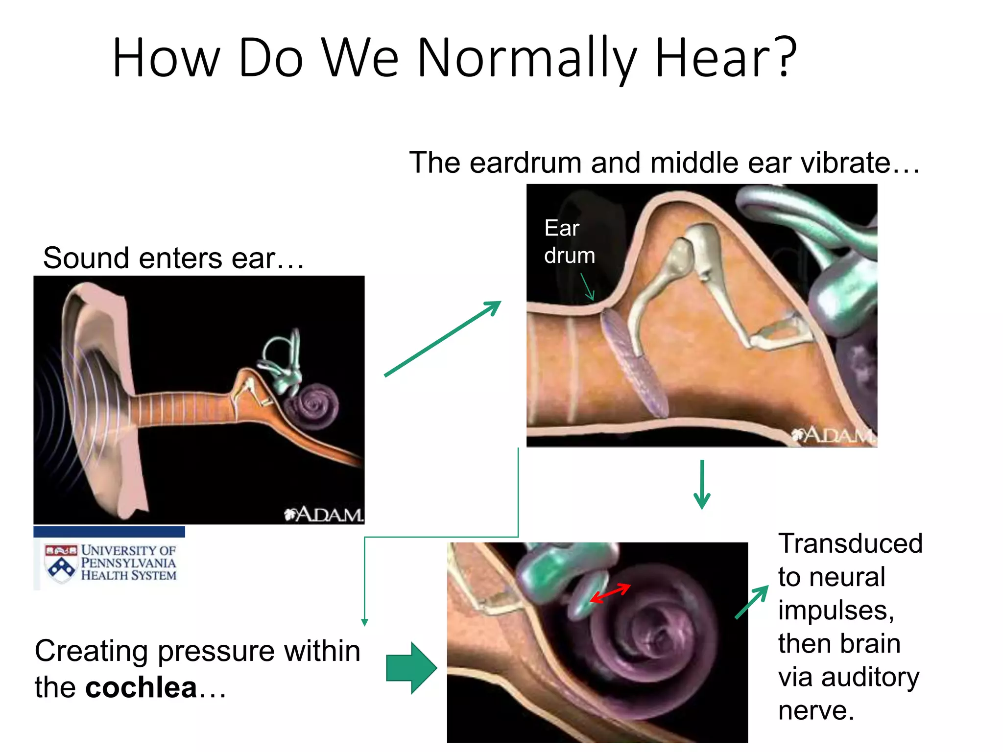 Auditory & Developmental Neurophysiology: Cochlear Implants seminar | PPTX
