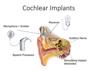 Auditory & Developmental Neurophysiology: Cochlear Implants seminar | PPTX