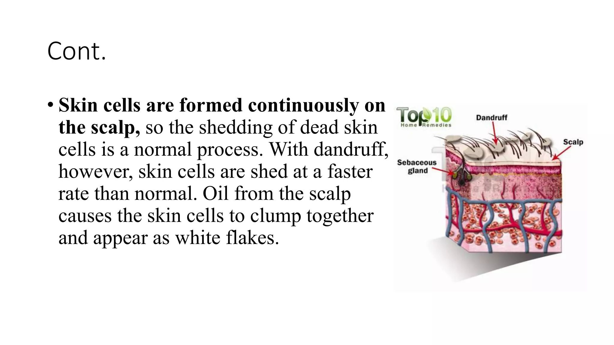 Dandruff | PPTX