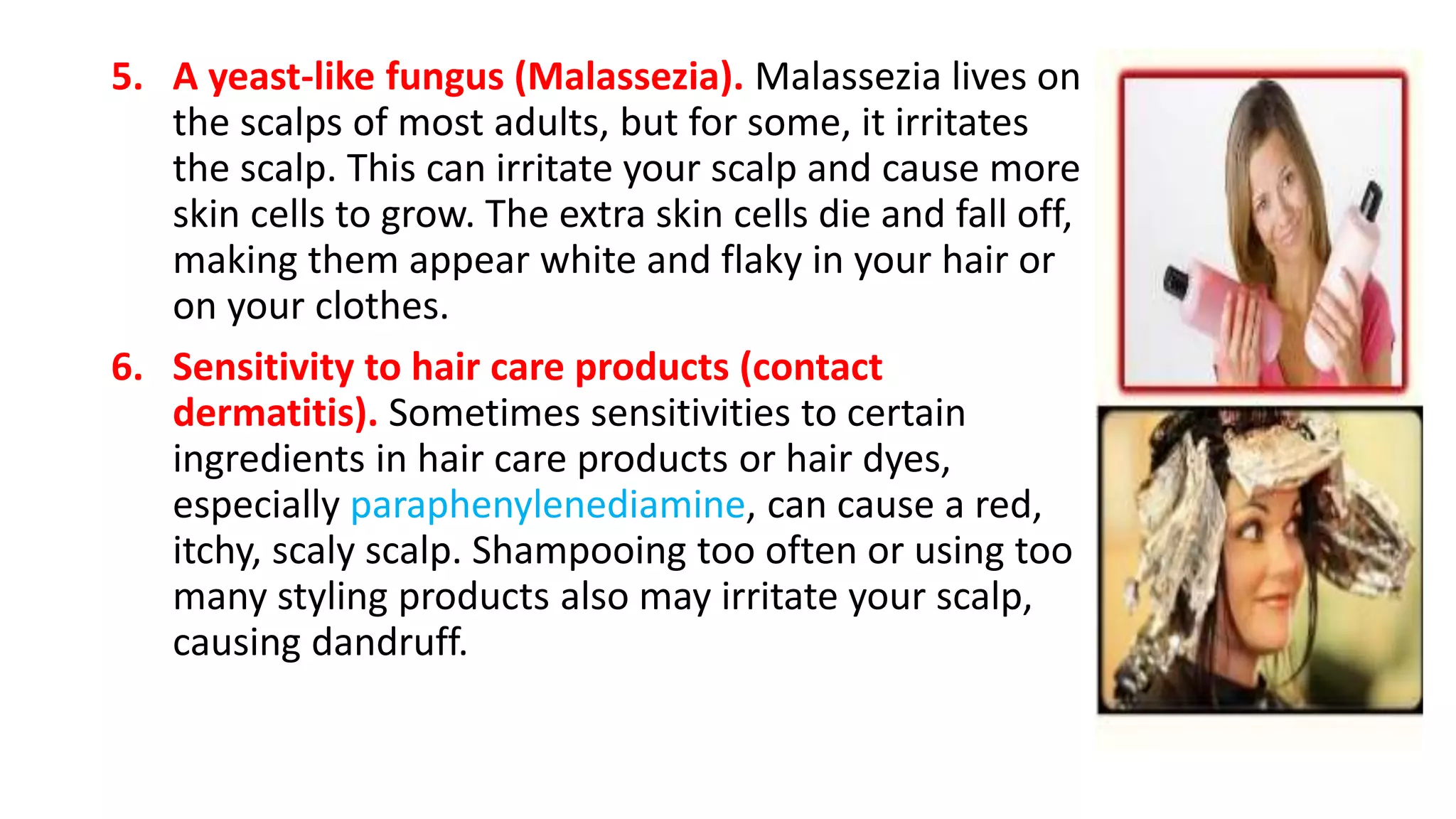 Dandruff | PPTX