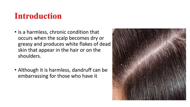 Dandruff | PPTX | Skin and Dermatology | Diseases and Conditions