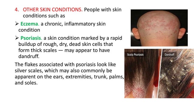 Dandruff | PPTX | Skin and Dermatology | Diseases and Conditions