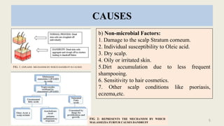 DANDRUFF COSMETICS.pptx