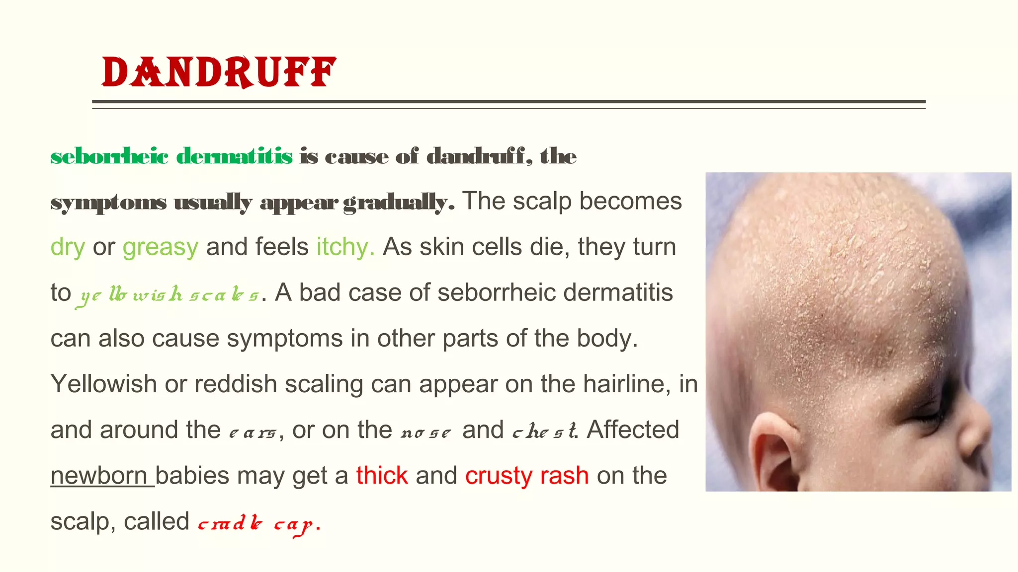 Dandruff | PPT